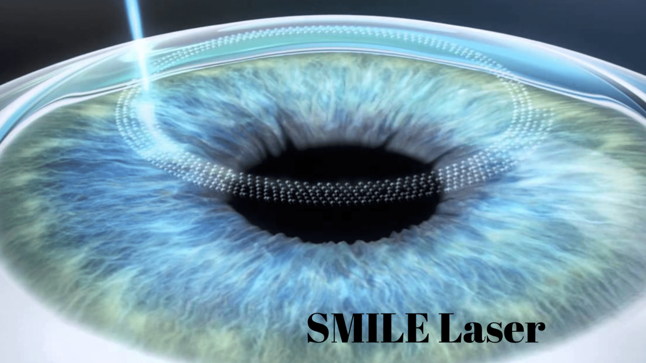 SMILE Eye Surgery | SMILE Treatment | Best SMILE Doctors