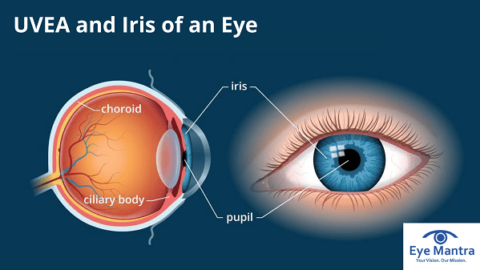 UVEA and Iris of an Eye | UVEA & Iris Treatment | EyeMantra